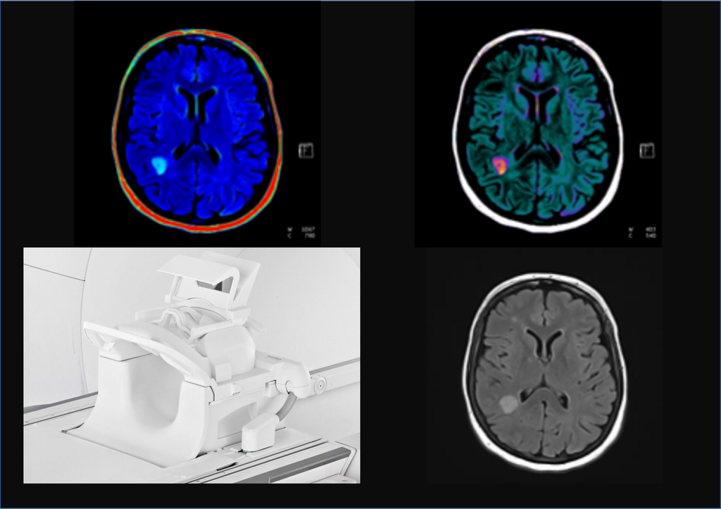 Introducing 3T MR Imaging with the New MAGNETOM Vida