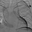 Scanner de Raio-X robótico duplo - Multitom Rax
