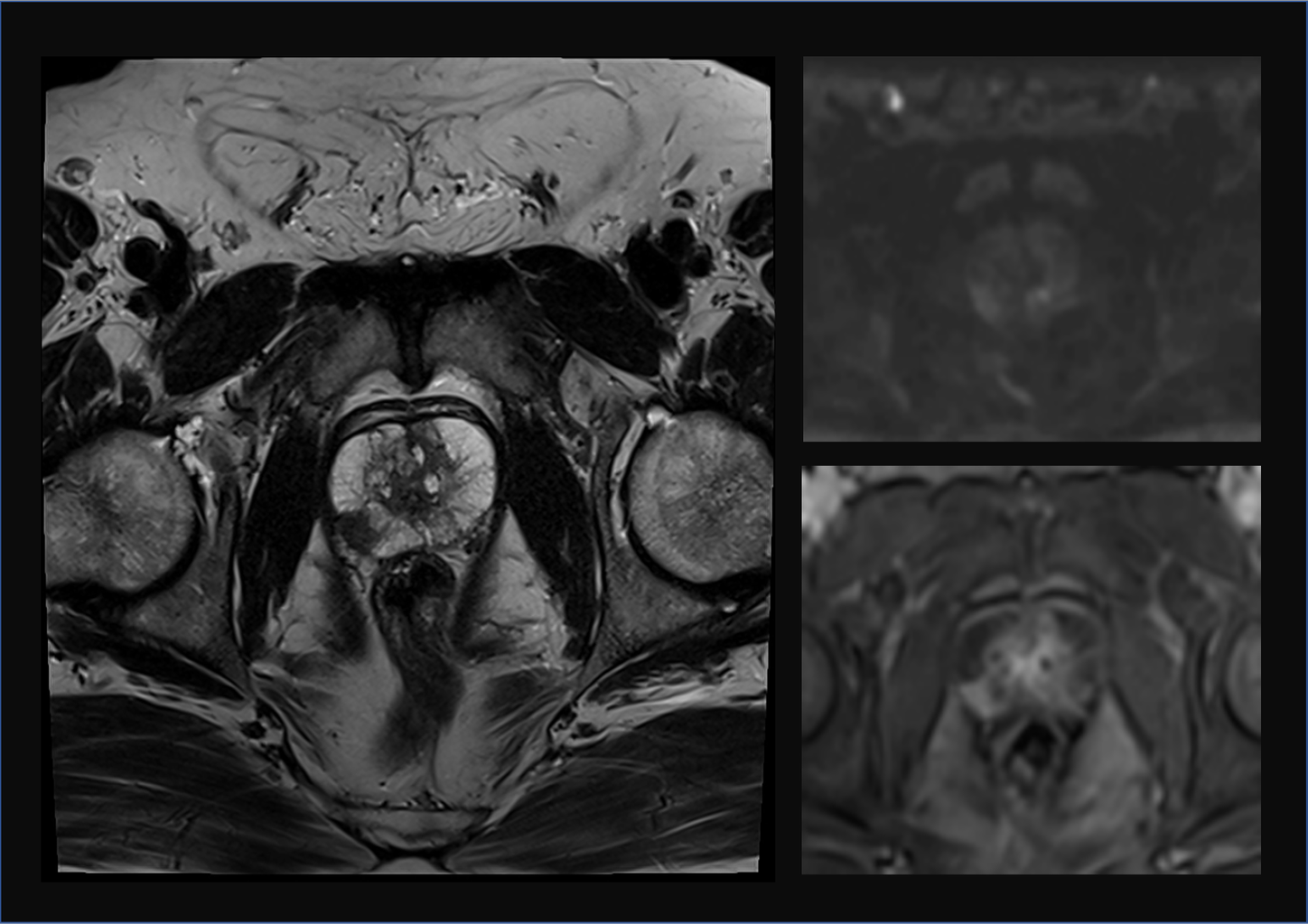 Introducing 3T MR Imaging with the New MAGNETOM Vida