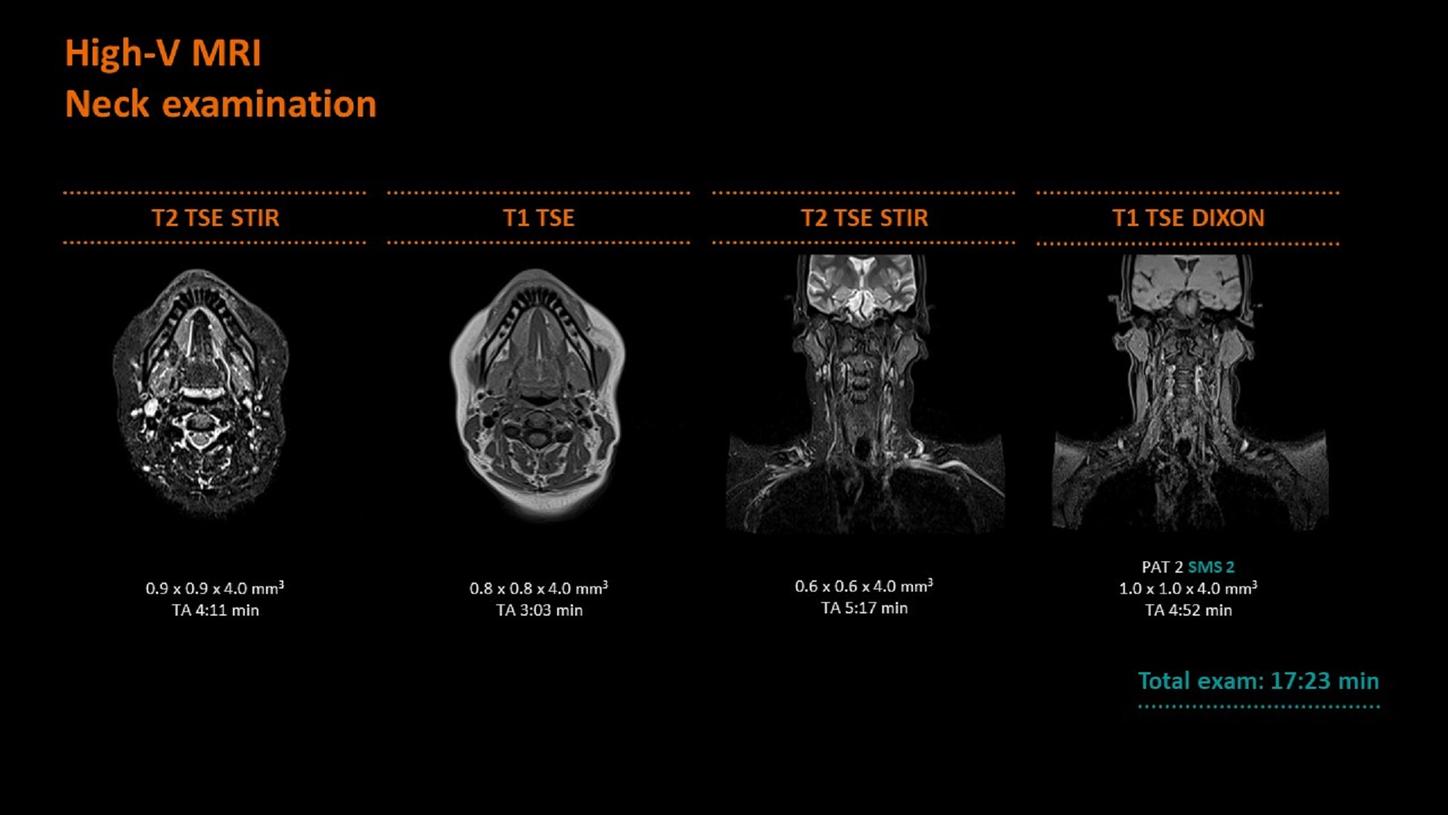 MAGNETOM Free.Max–wide bore mri