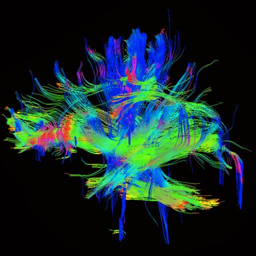 DTI Tractography