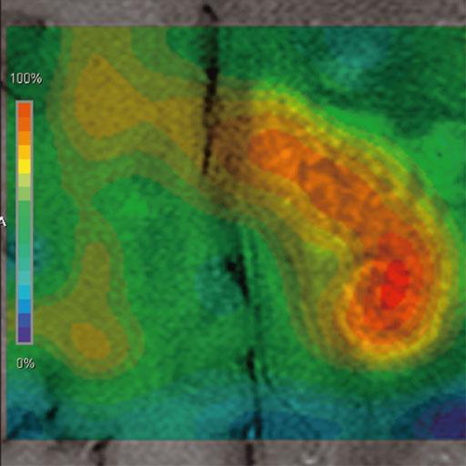 Chemical Shift Imaging (CSI)