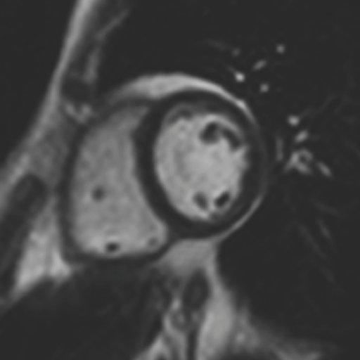 Body/Spine Array Coil, medium