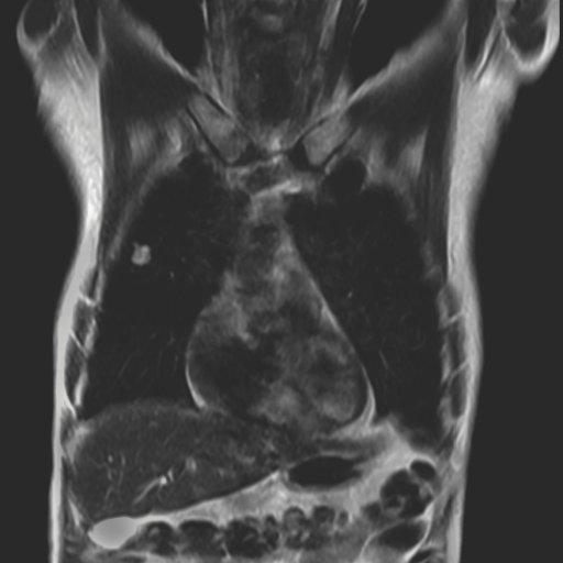 Body Spine Array Coil, XL