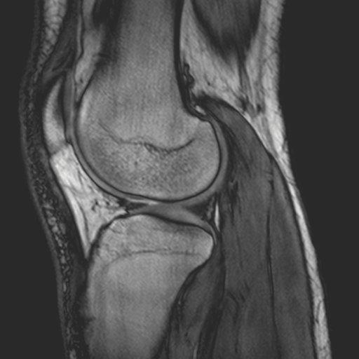 Extremity Array Coil, XL