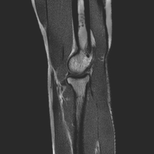 Extremity Array Coil, XL