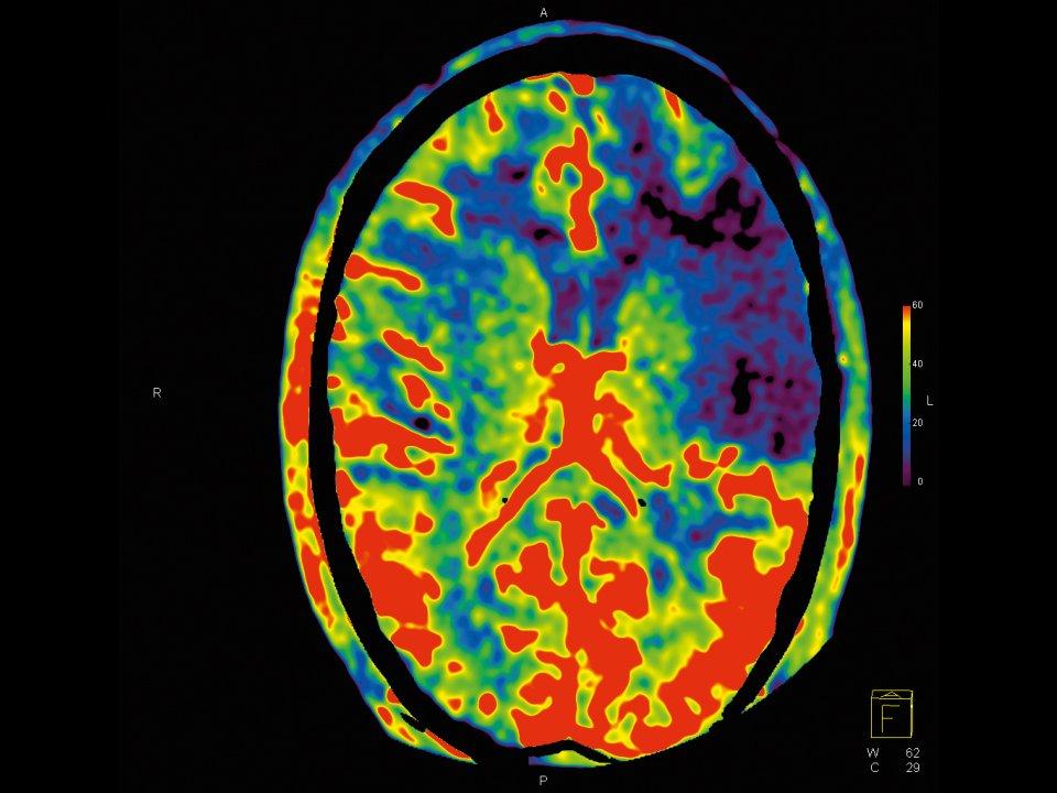 Artis zee biplane system eco for Interventional Radiology