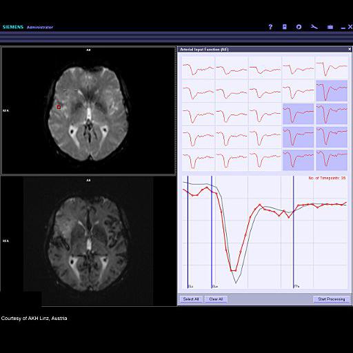 syngo.MR Neuro Perfusion Engine