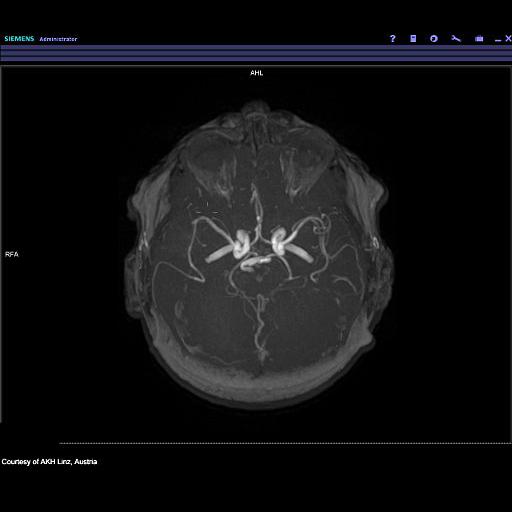 syngo.MR Neuro Perfusion Engine