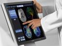MR Neuro Imaging - MRI Neurology