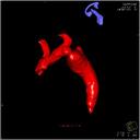 syngo DynaCT Cardiac