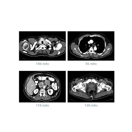 Approaches to Dose Reduction in Computed Tomography