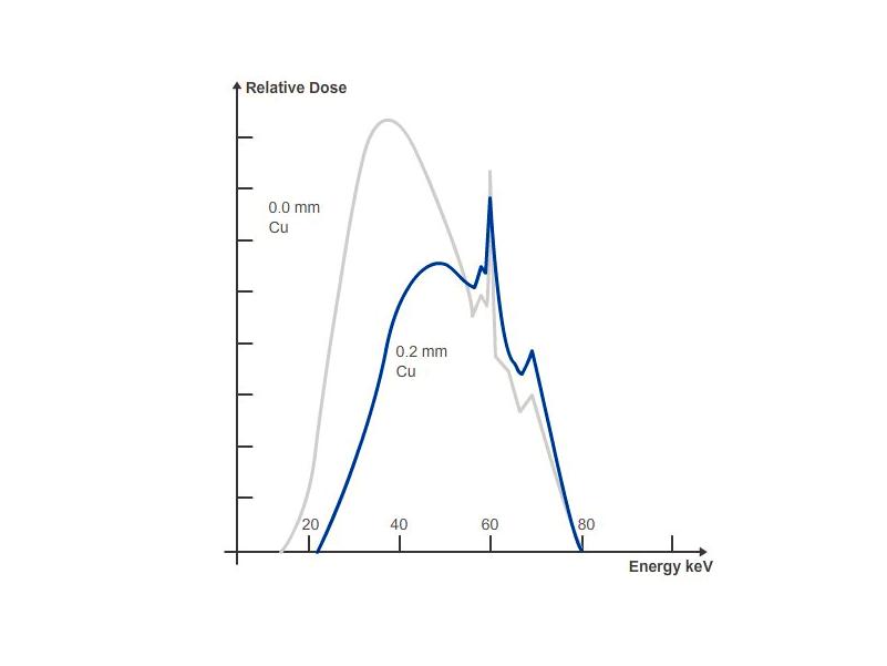 Siemens Healthcare – Luminos RF Classic