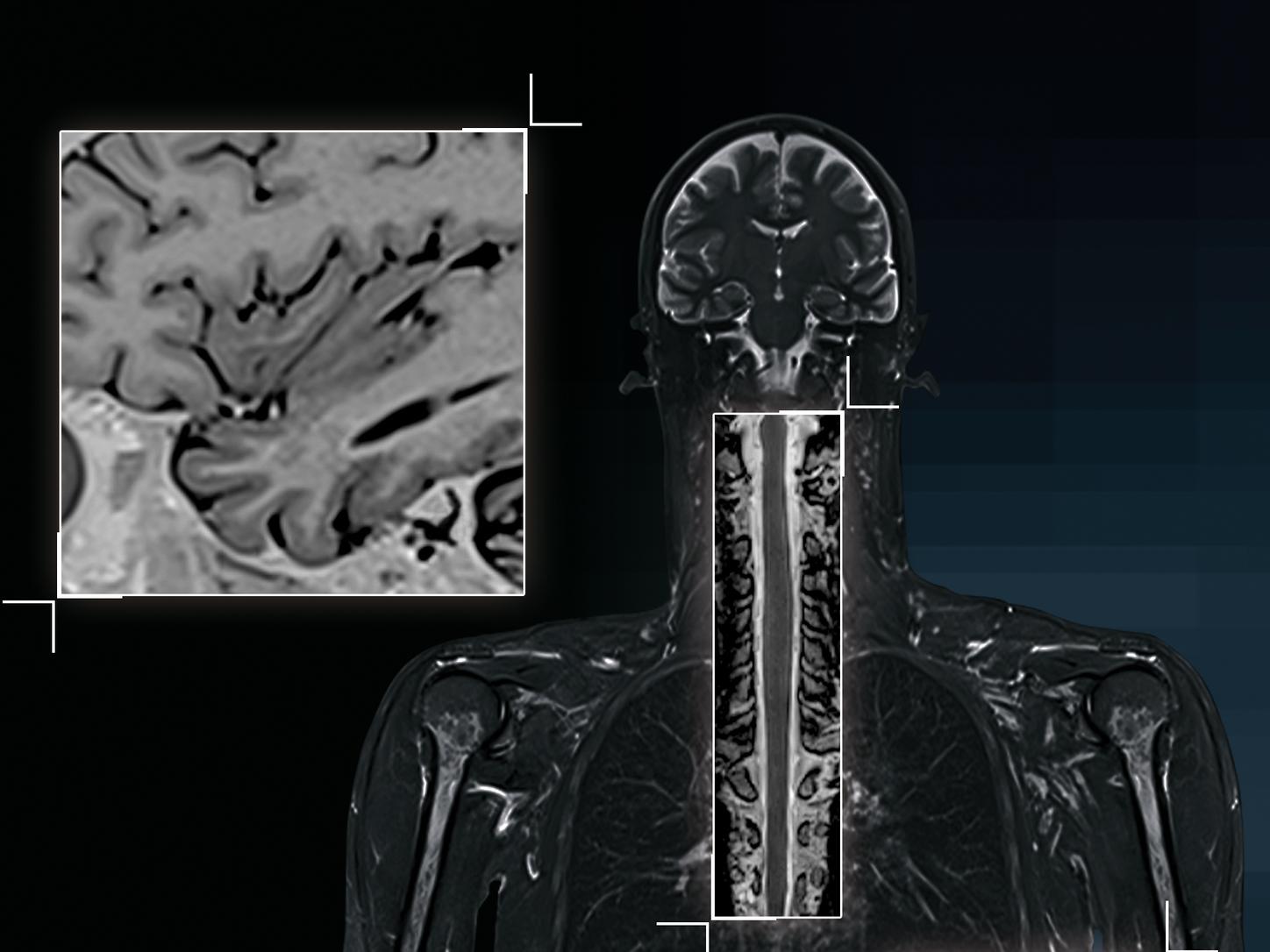 MAGNETOM Prisma - MRI Scanner