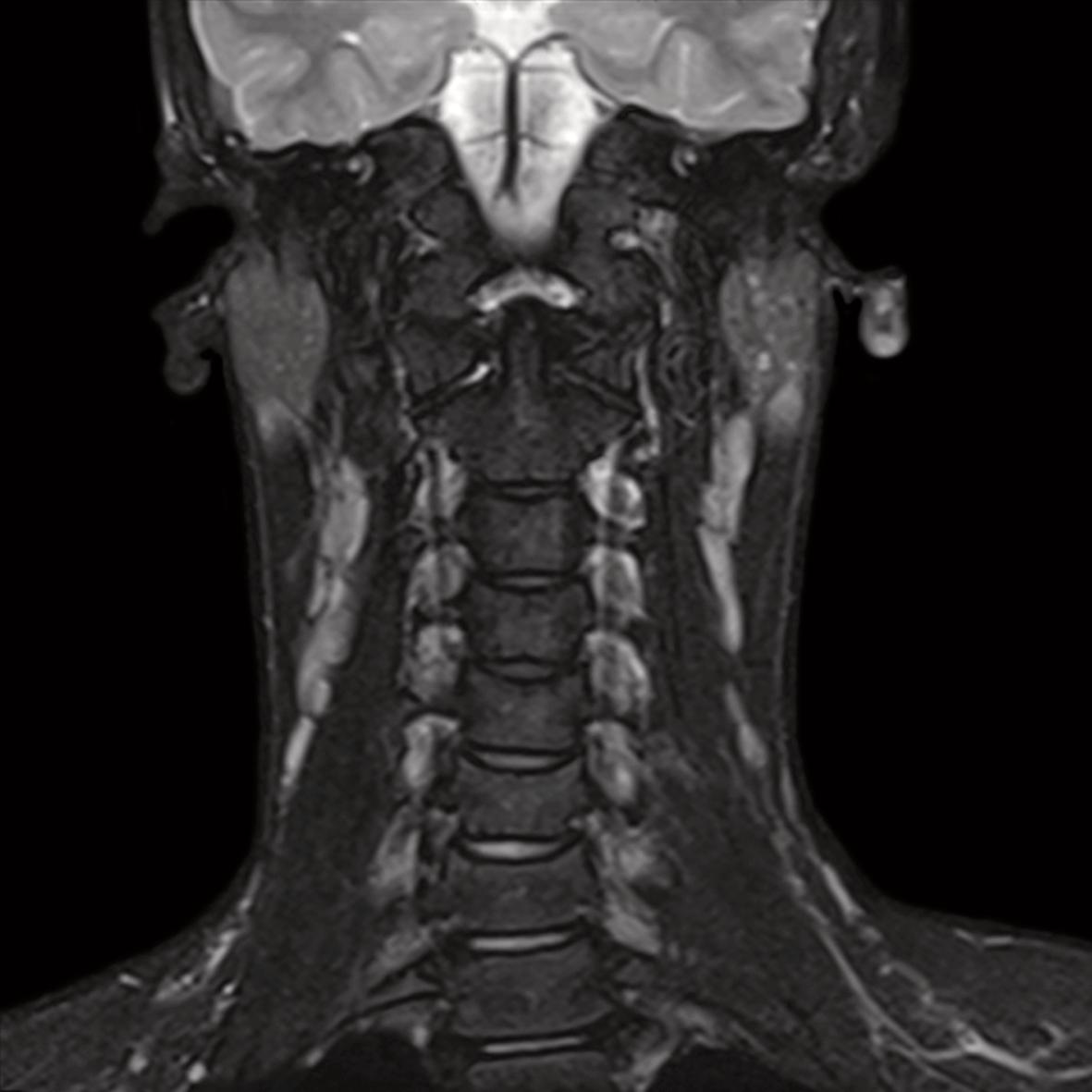 Magnetic Resonance Imaging – Clinical Images