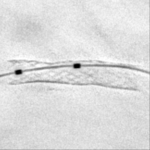 Artis zee biplane system eco for Interventional Radiology