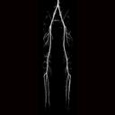 MAGNETOM Skyra - Peripheral Angiography