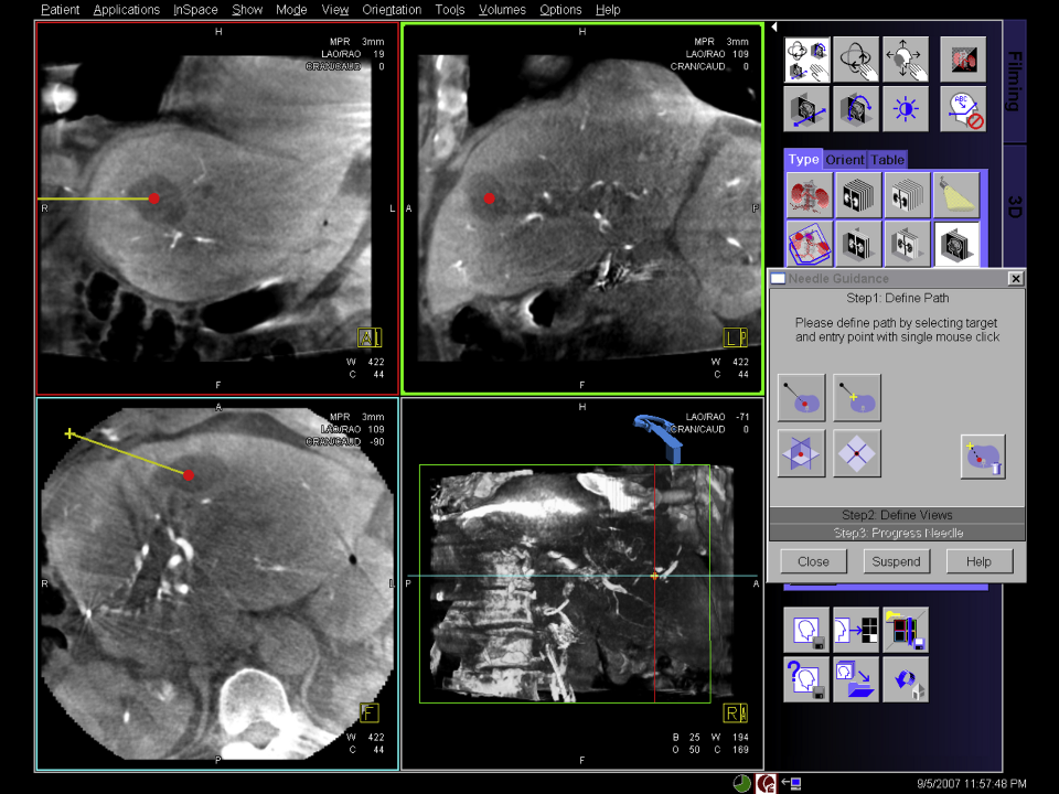 Artis zee biplane system eco for Interventional Radiology