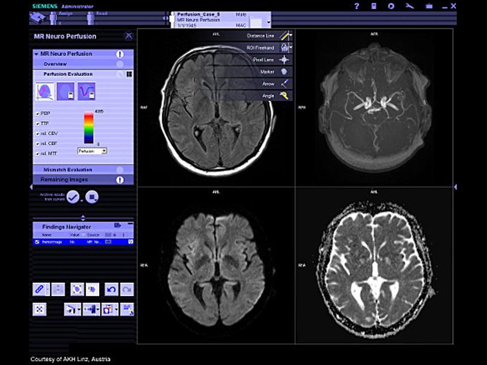CT Scanner SOMATOM Scope