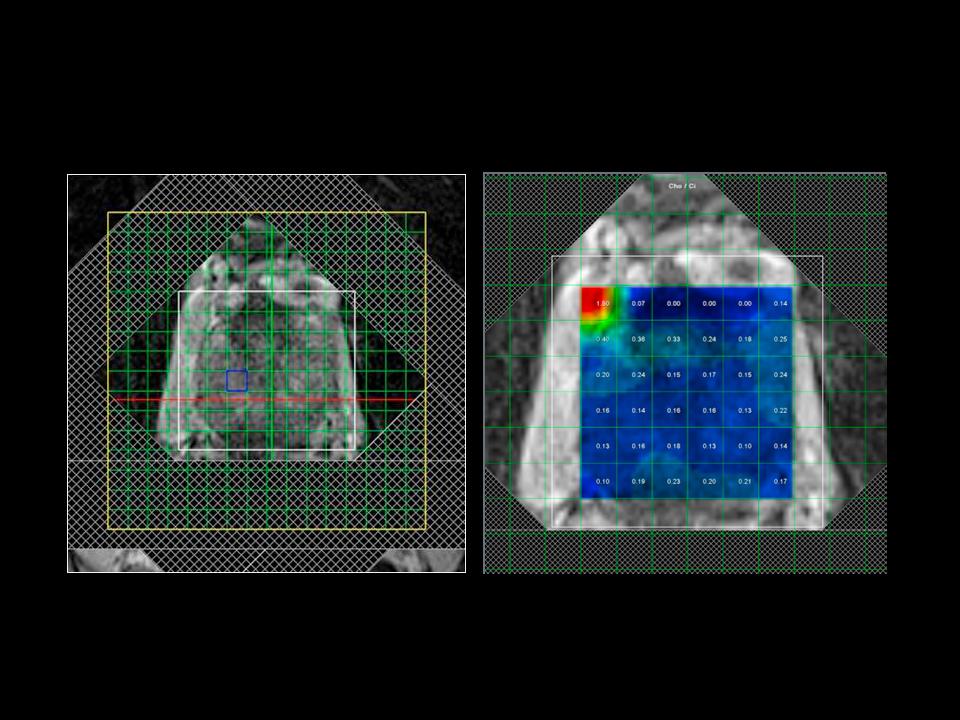 MAGNETOM Prisma - MRI Scanner
