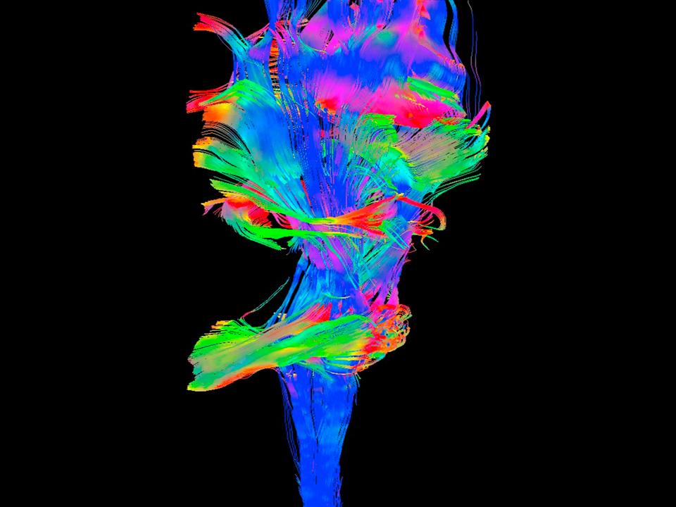 MAGNETOM Prisma - MRI Scanner