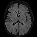 MAGNETOM Verio Upgrade