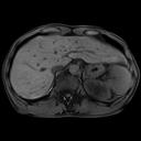 MAGNETOM Verio Upgrade