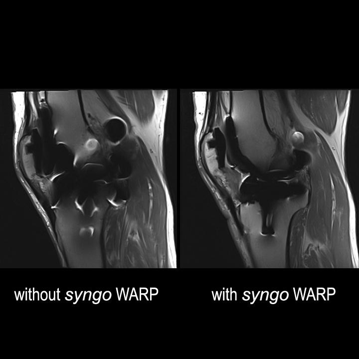 syngo WARP