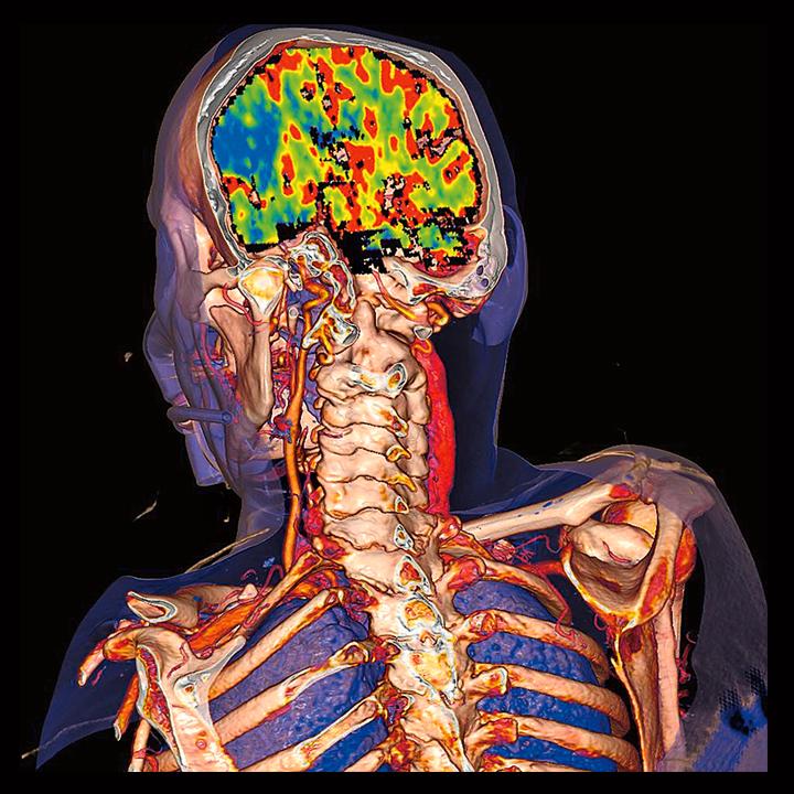 SOMATOM Definition Flash