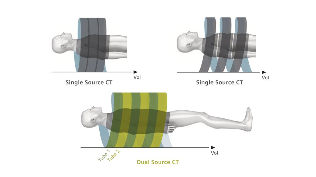 SOMATOM Definition Flash - CT Scanner