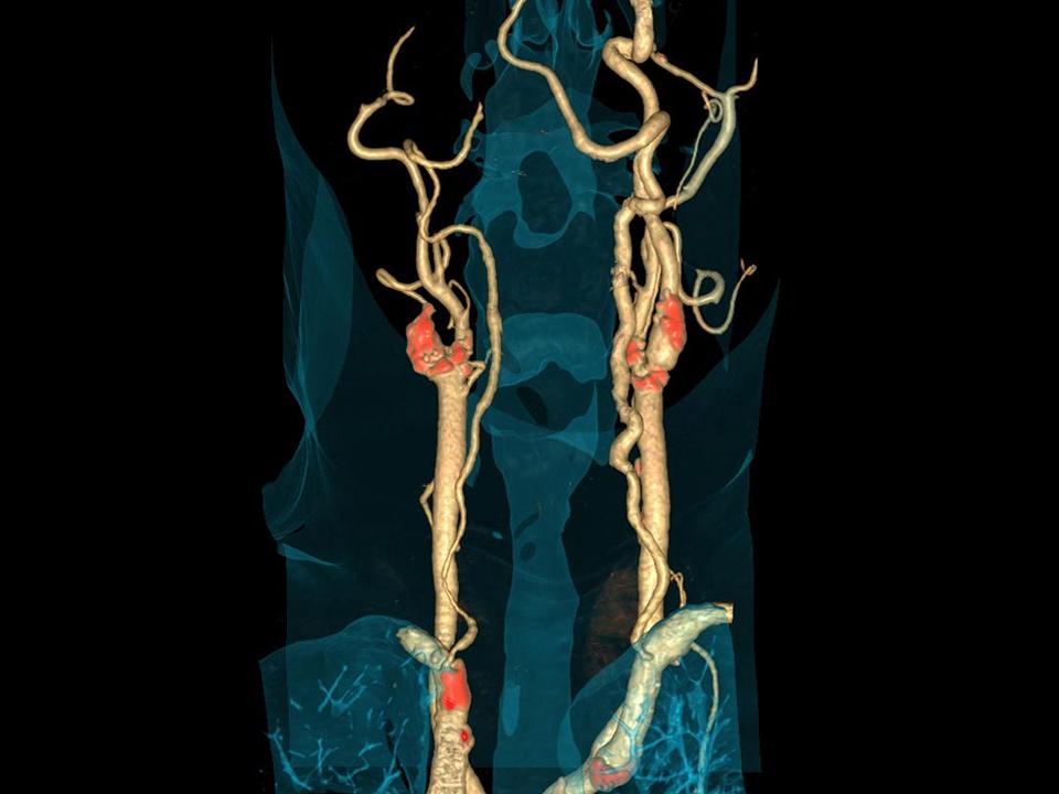 Get further. With True Dual Energy.