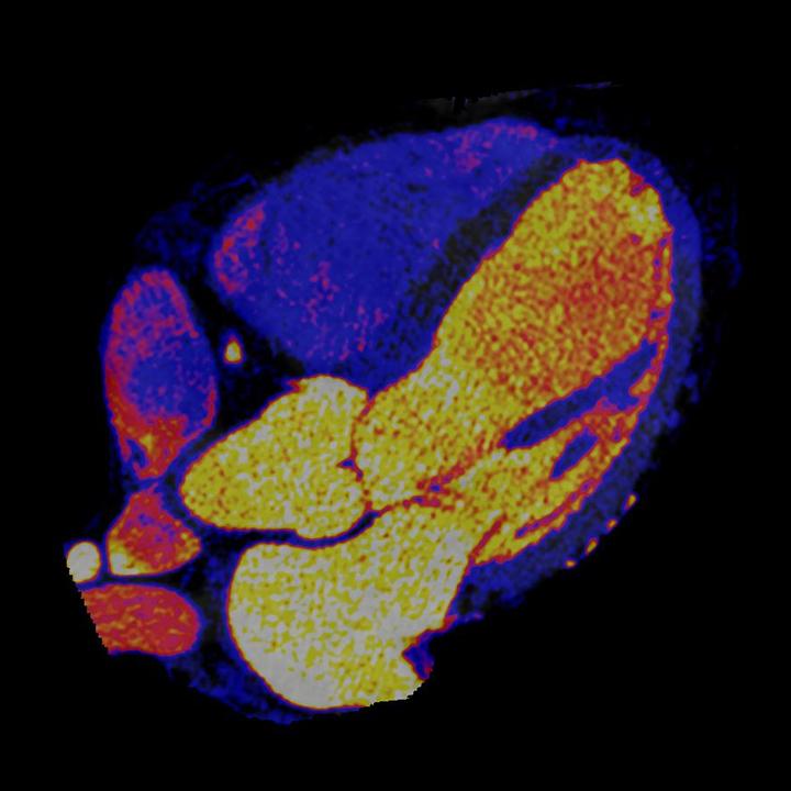 Get further. With True Dual Energy.