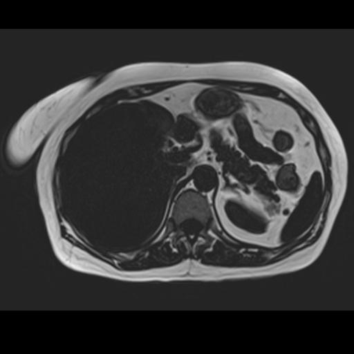 Siemens Growth with Body MRI