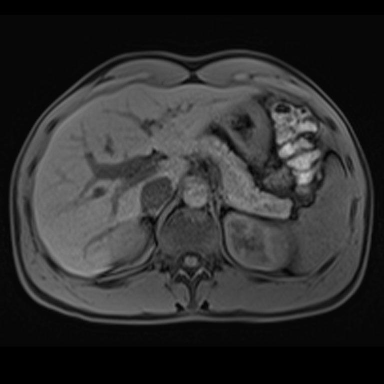 Siemens Growth with Body MRI