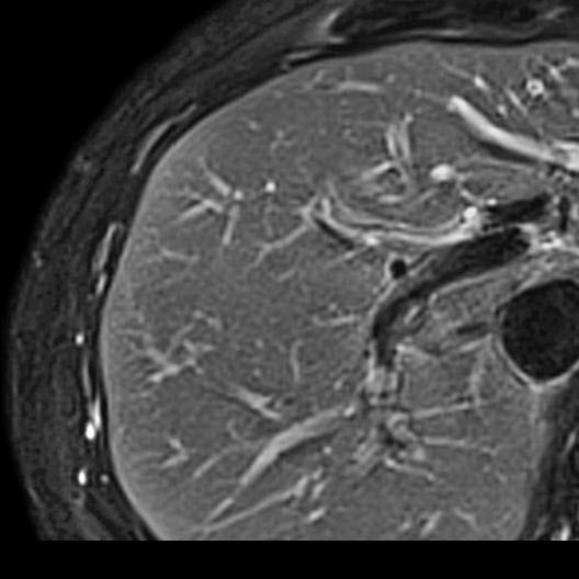 Siemens Growth with Body MRI