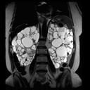 Siemens Growth with Body MRI