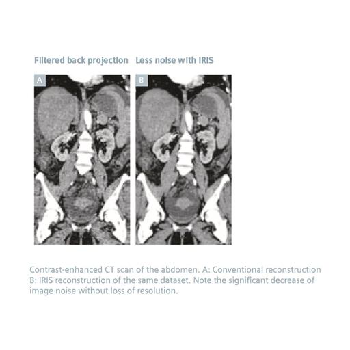 Approaches to Dose Reduction in Computed Tomography