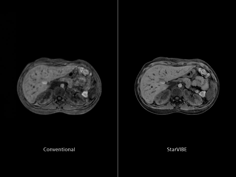 Siemens Growth with Body MRI