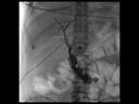 Luminos dRF Max Fluoroscopy Machine
