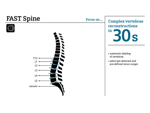 CT Scanner SOMATOM Scope