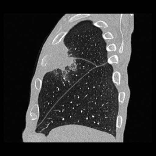 CT Scanner SOMATOM Scope