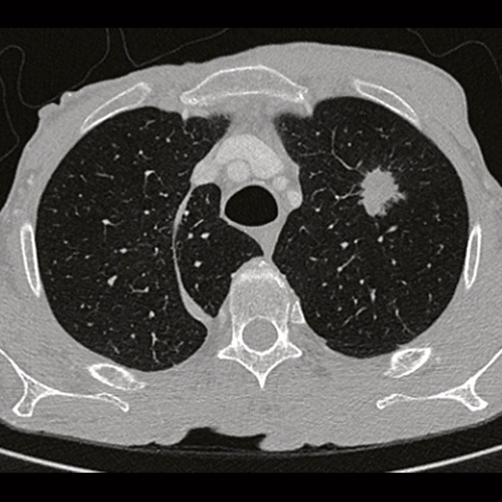 CT Scanner SOMATOM Scope