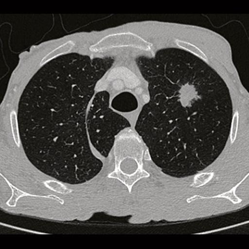 CT Scanner SOMATOM Scope