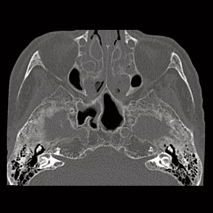 CT Scanner SOMATOM Scope