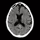 CT Scanner SOMATOM Scope