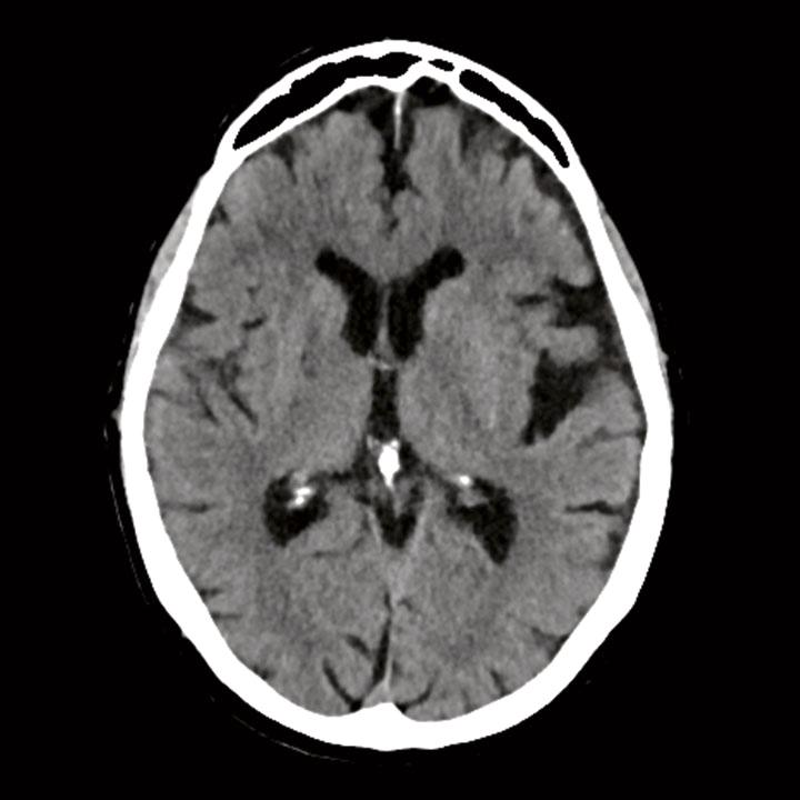 CT Scanner SOMATOM Scope