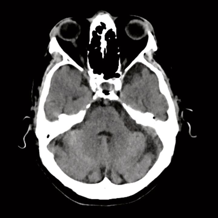 CT Scanner SOMATOM Scope