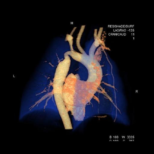 SOMATOM Definition Flash - CT Scanner