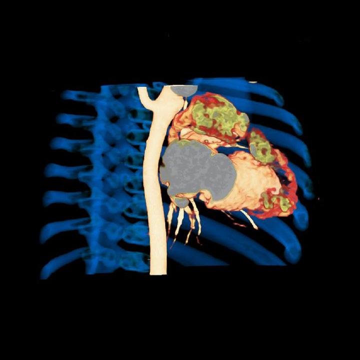 SOMATOM Definition Flash - CT Scanner