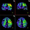 SOMATOM Definition Flash - CT Scanner